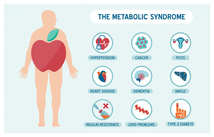Metabolic Syndrome | Symptoms, Causes, Natural Treatments
